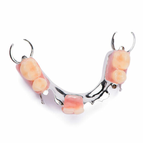 Partial Dentures in the North Battleford